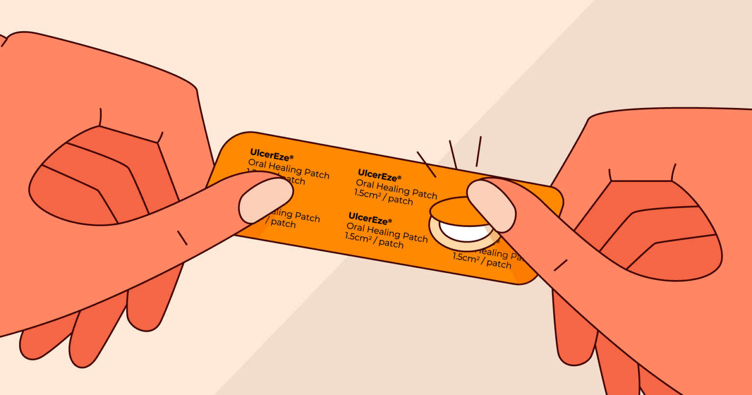 Mouth Ulcer Patch & Ulcer Treatment | UlcerEze