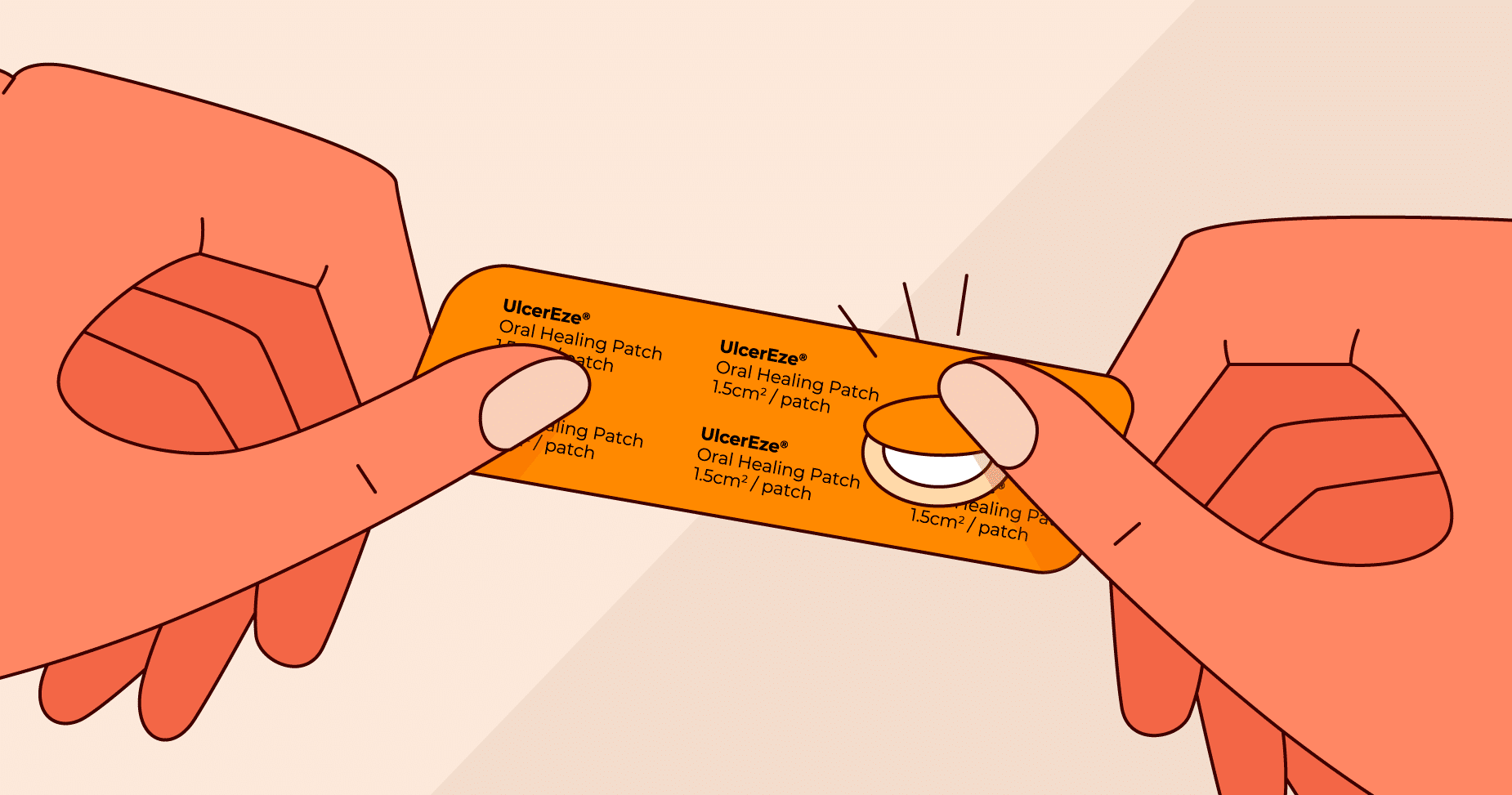 Mouth Ulcer Patch & Ulcer Treatment | UlcerEze